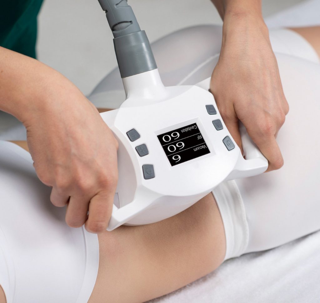 Exploring Cryolipolysis How This Technology Revolutionized Fat Reduction